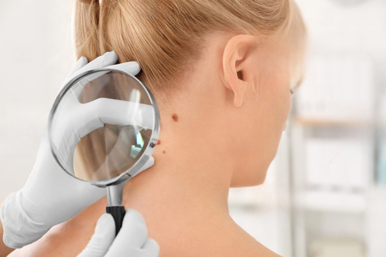 Skin Lesion Removal | Venuscosmedical